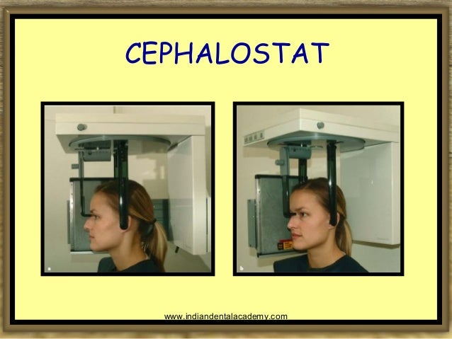 Cephalometry (2)