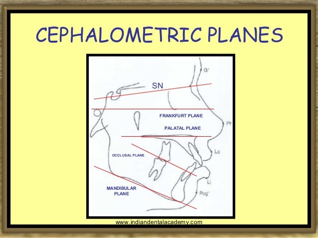 Cephalometry (2)