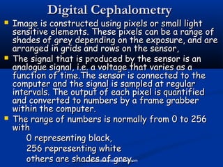 Cephalometry | PPT