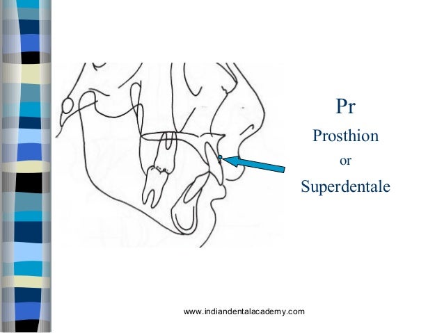 Prosthion — Conseil Dentaire Dr.Hauteville