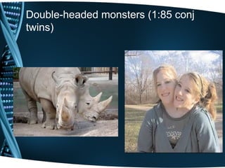 cranio-Cephalopagus | PPT