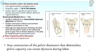 Cephalopelvic disproportion 2021 | PDF