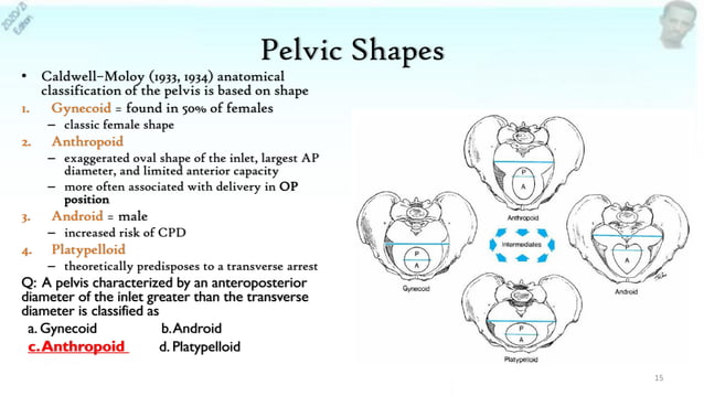 Cephalopelvic disproportion 2021 | PDF | Pregnancy | Reproductive Health