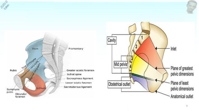 Cephalopelvic disproportion 2021 | PDF | Pregnancy | Reproductive Health