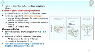 Cephalopelvic Disproportion