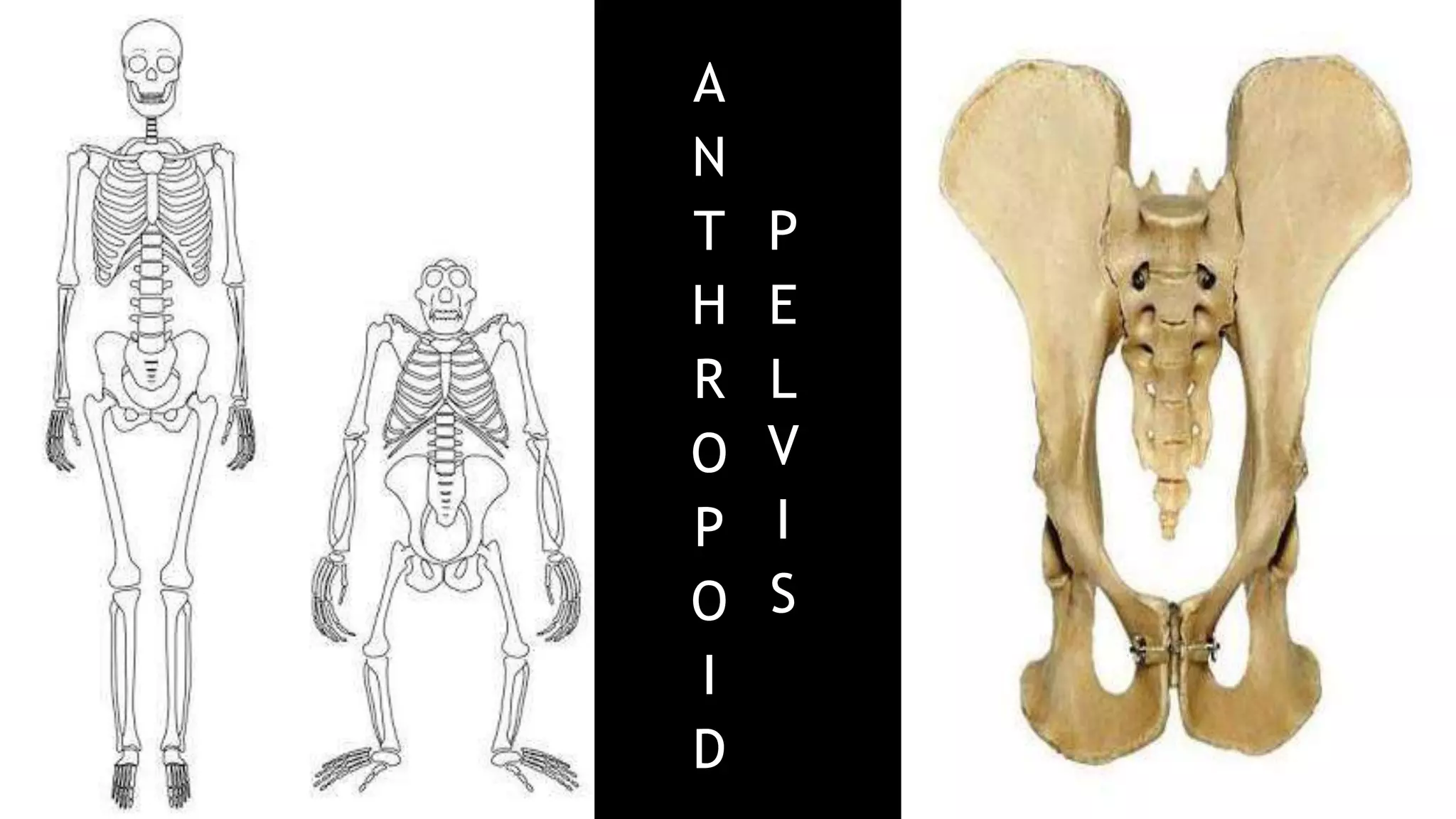Cephalopelvic disproportion | PPTX