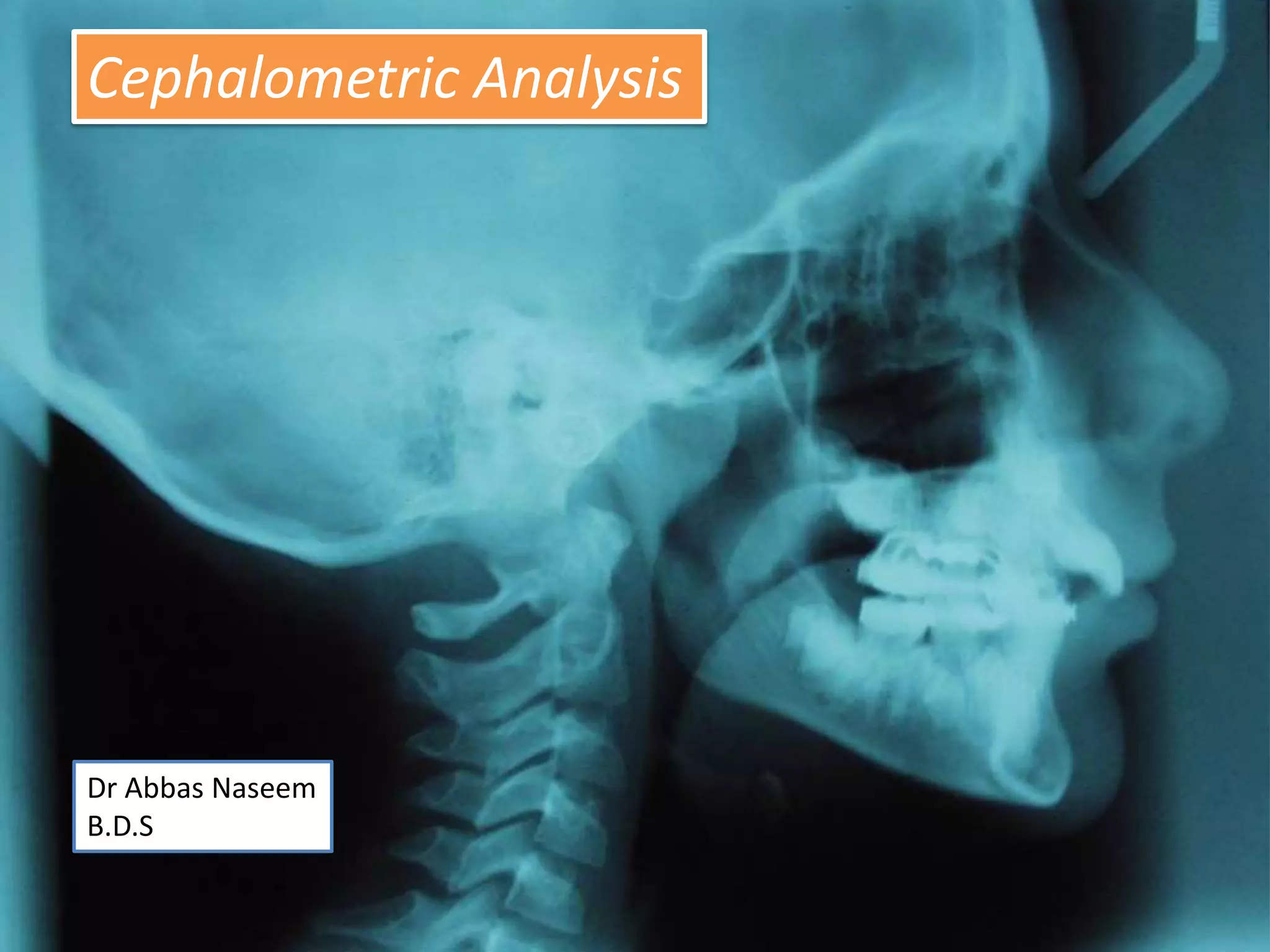 Cephalometric analysis | PPTX