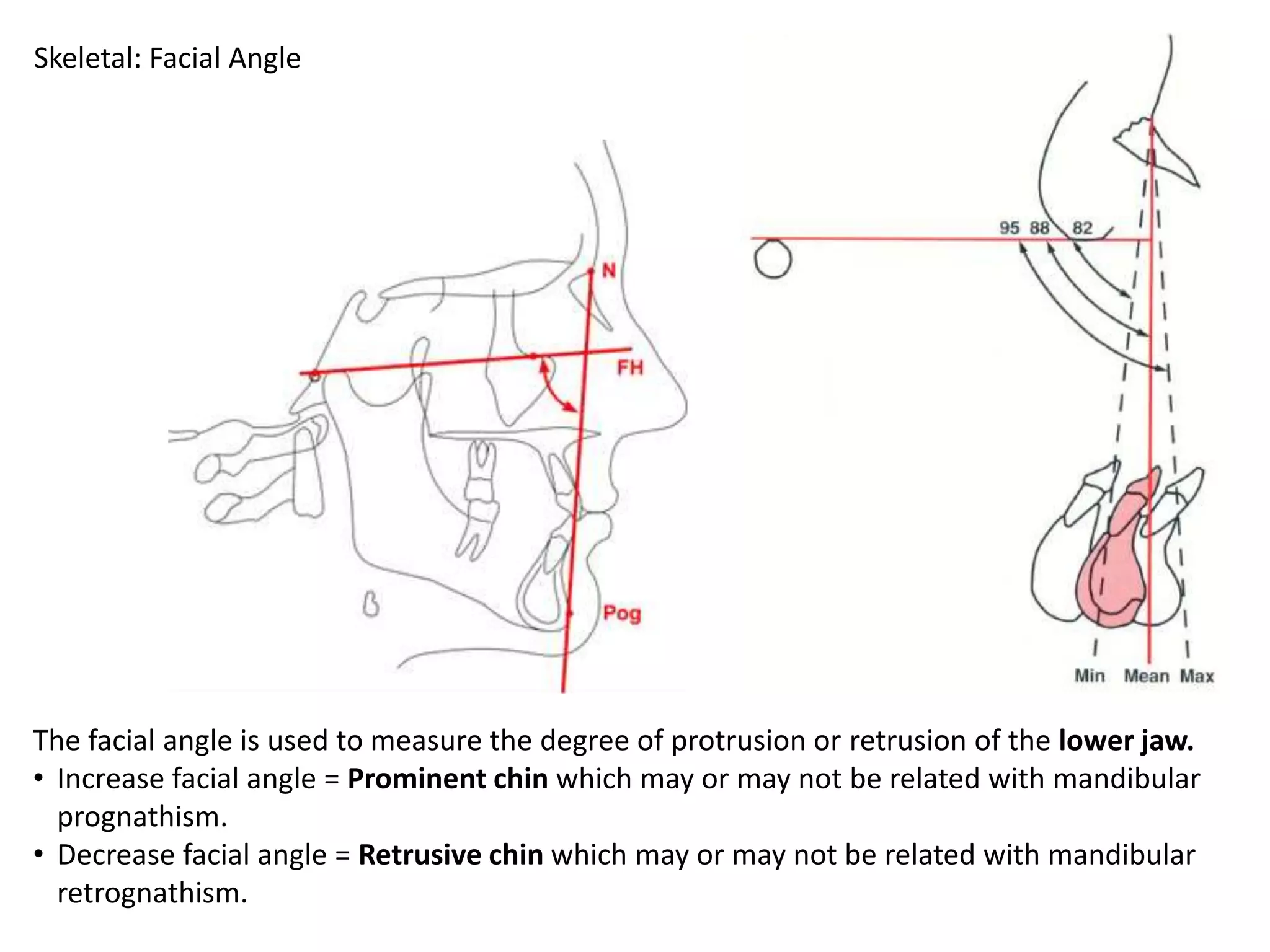 Cephalometric analysis | PPTX