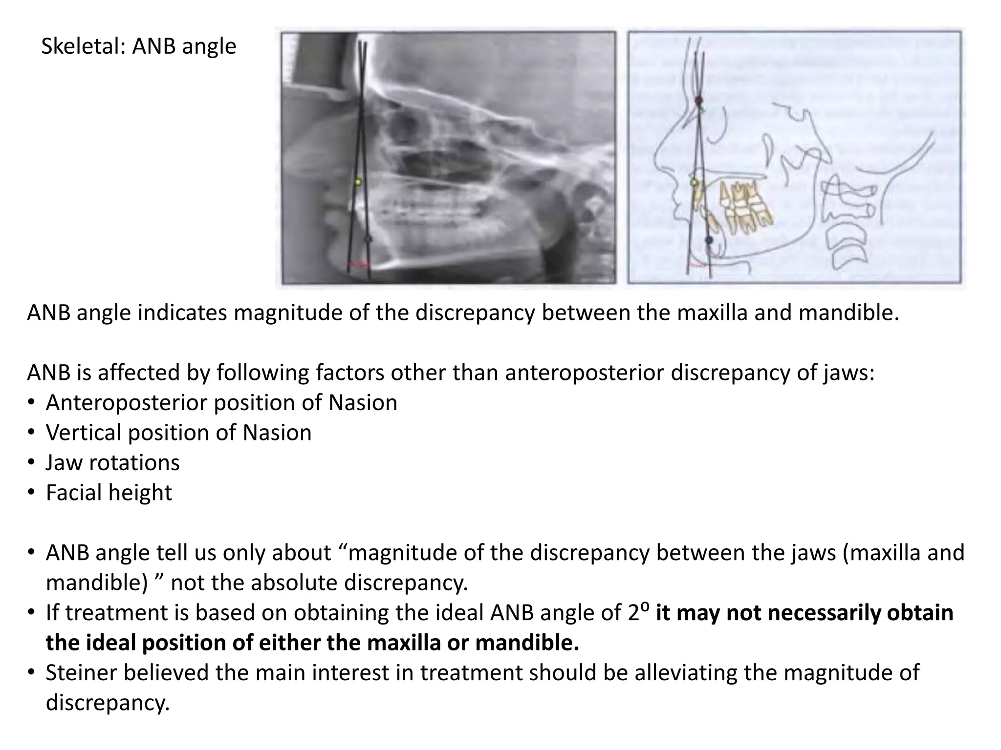 Cephalometric analysis | PPTX