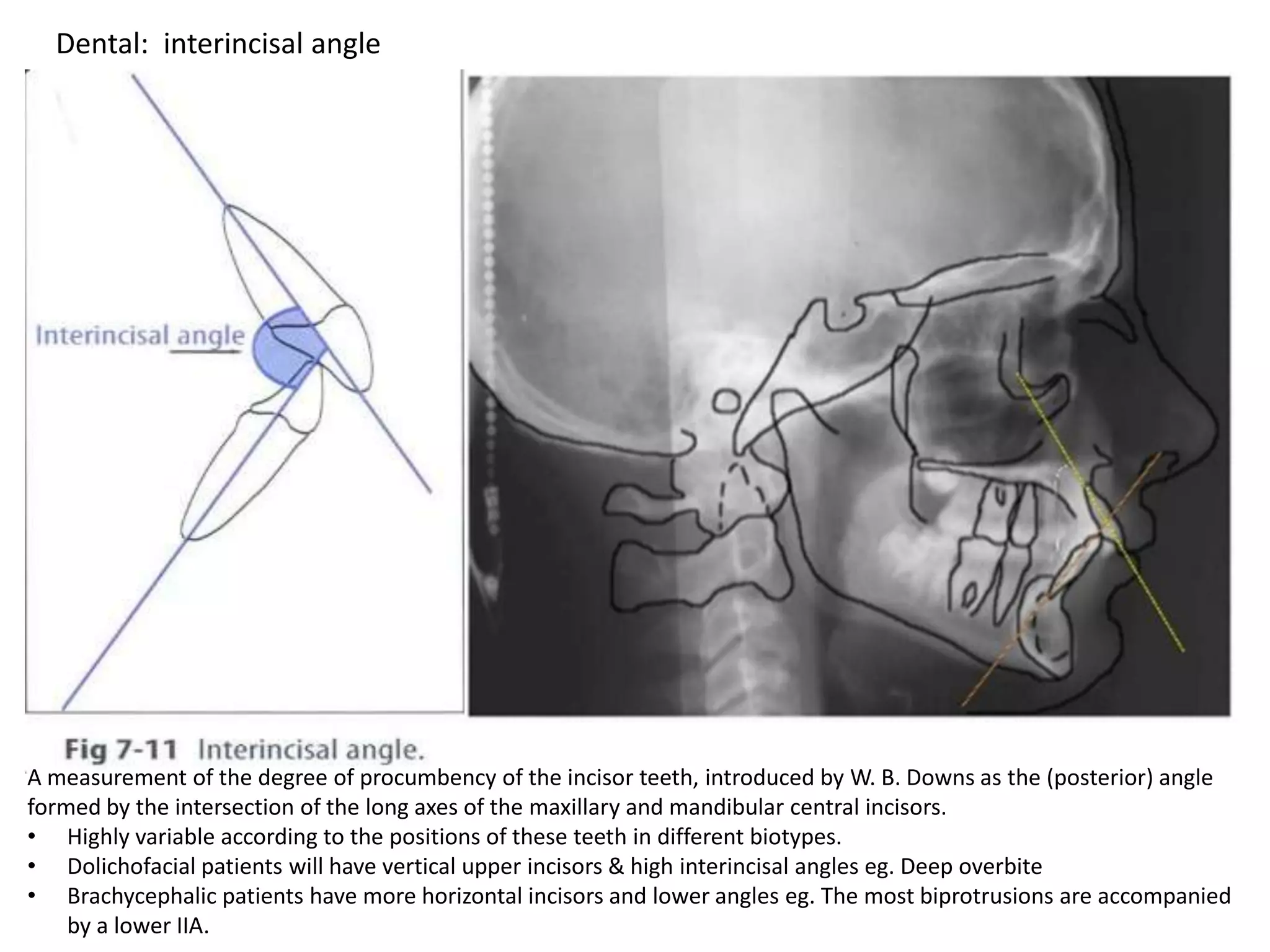 Cephalometric analysis | PPTX