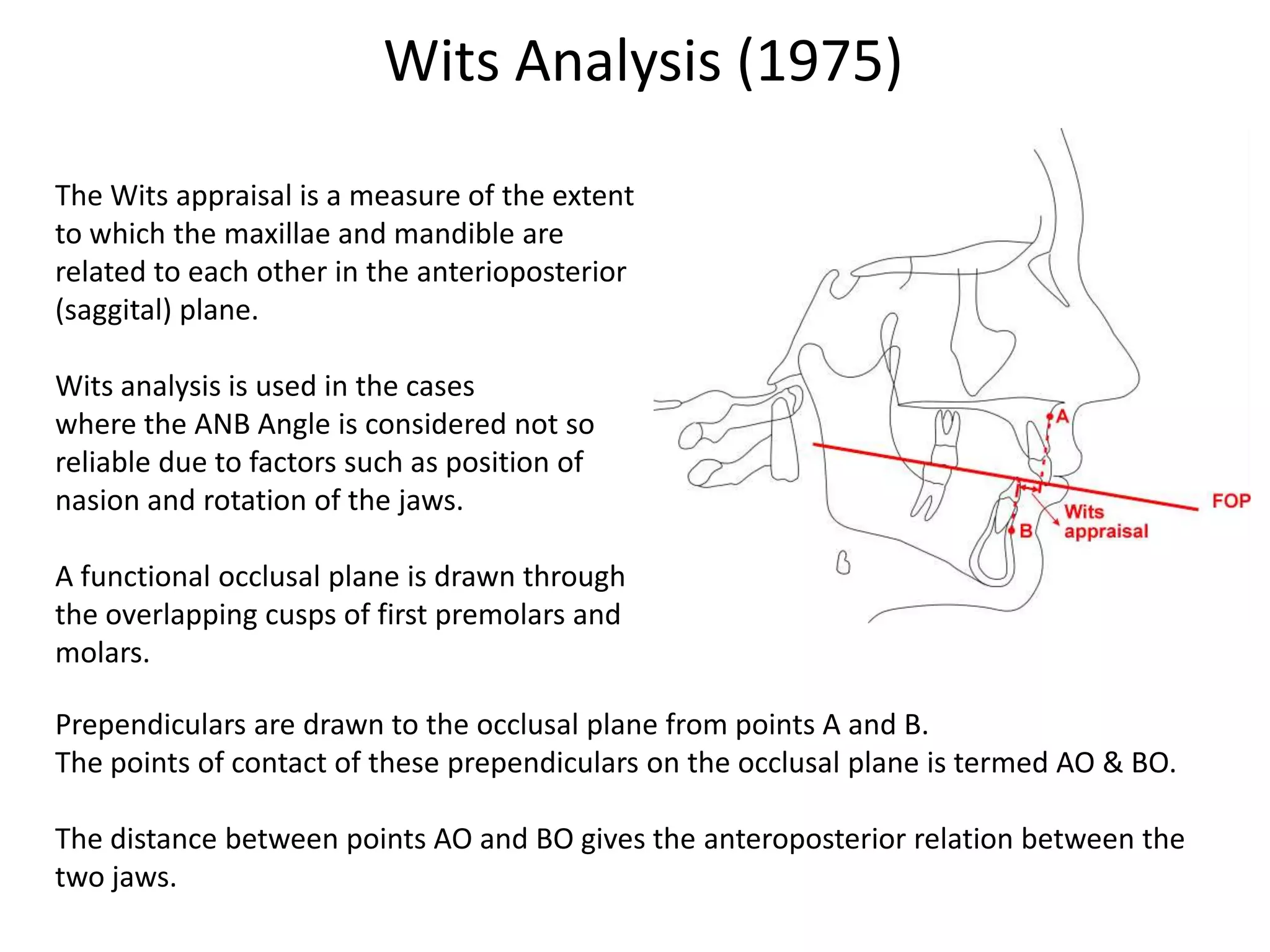 Cephalometric analysis | PPTX