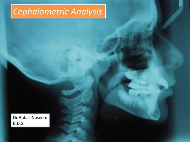 Cephalometric analysis | PPTX | Dental Health | Diseases and Conditions