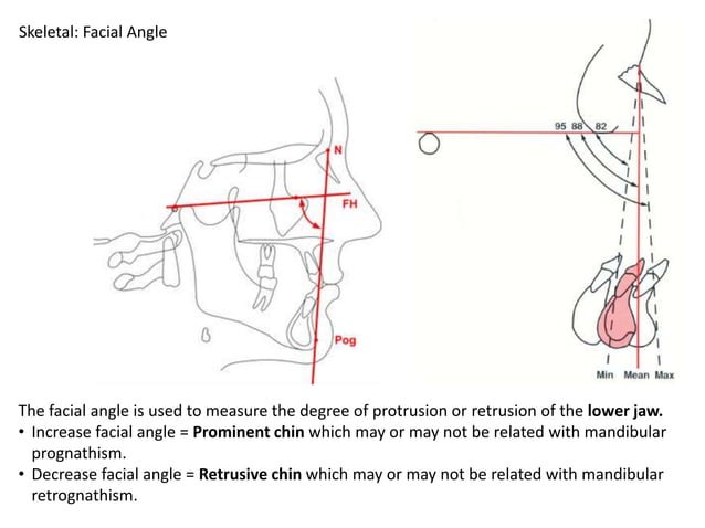Cephalometric analysis | PPTX | Dental Health | Diseases and Conditions