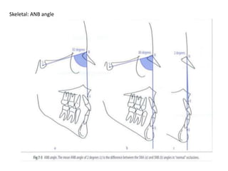 Cephalometric analysis | PPTX