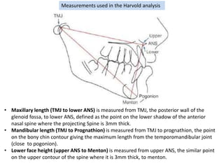 Cephalometric analysis | PPT