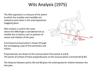 Cephalometric analysis | PPT