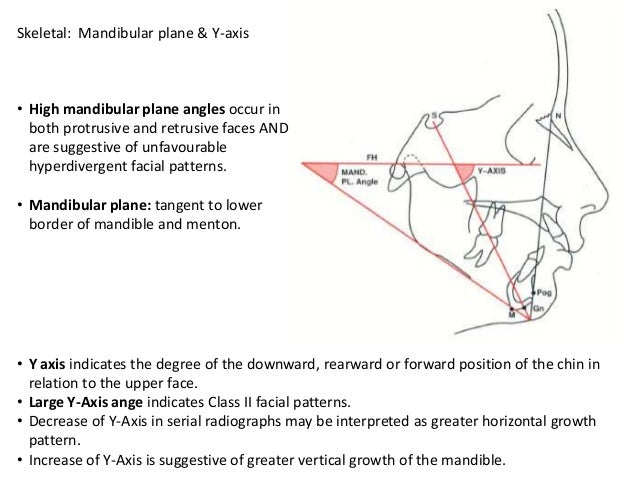 Cephalometric analysis