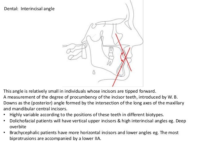 Cephalometric analysis