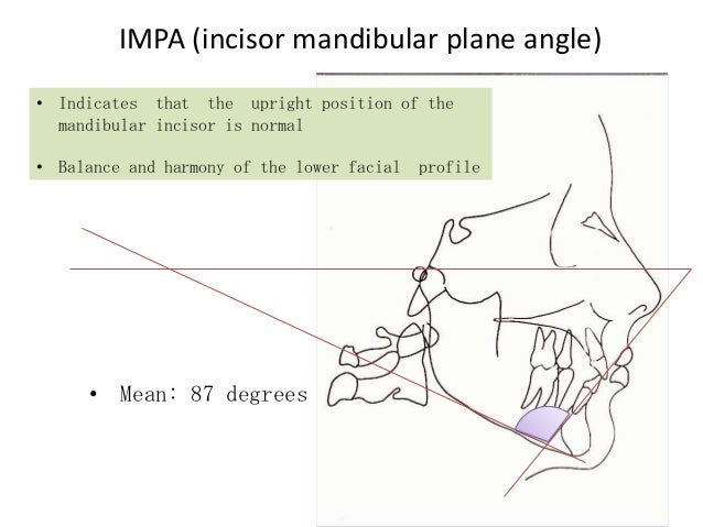 Cephalometric analysis