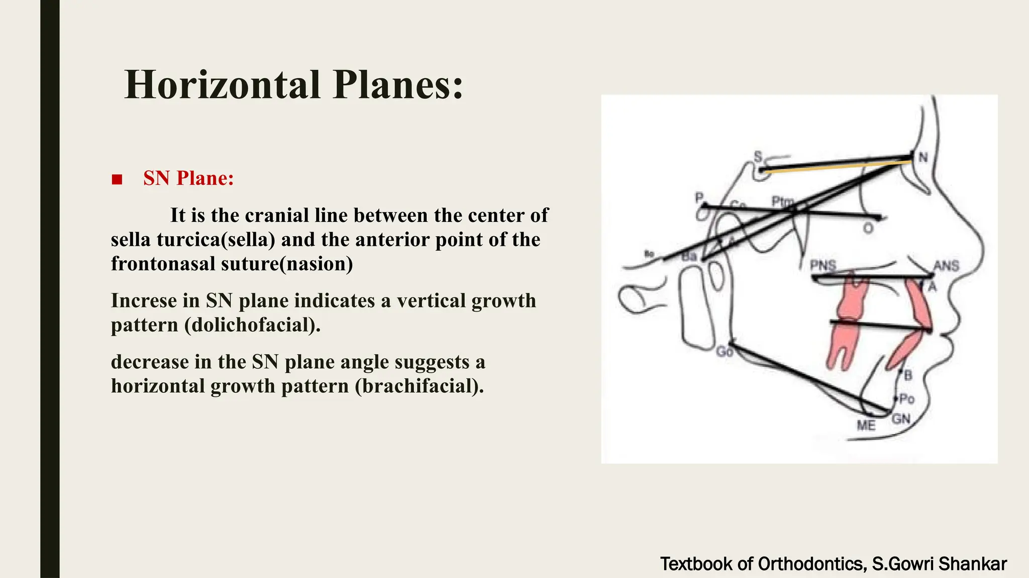 ceph_LLP_SEMINAR[2].pptx landmarks lines and planes | PPTX
