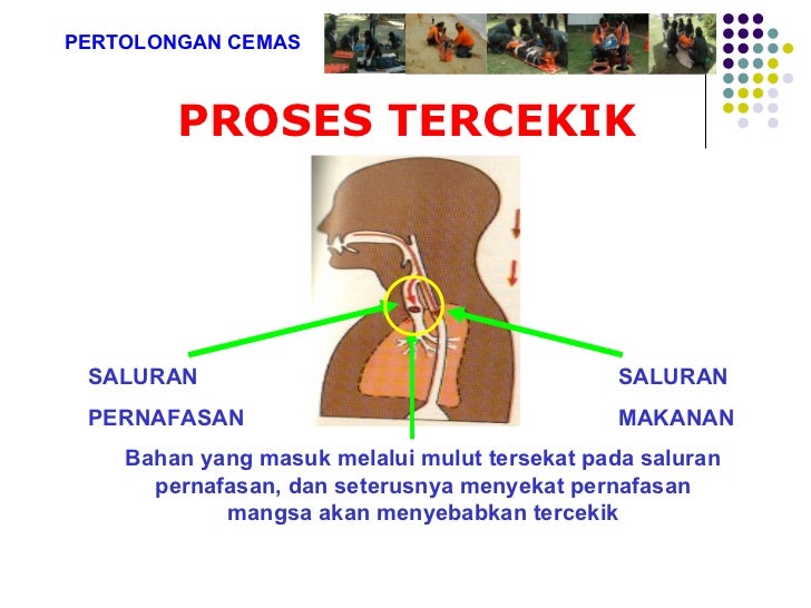 Ceramah bls choking