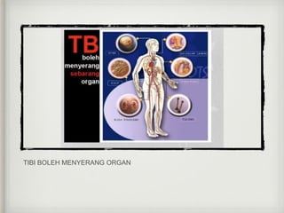 Ceramah kesihatan PENYAKIT TIBI | PPT