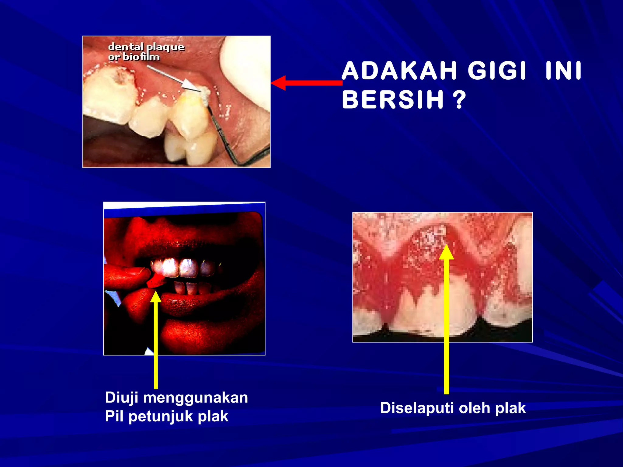 Ceramah pergigian tahap 1 | PPT