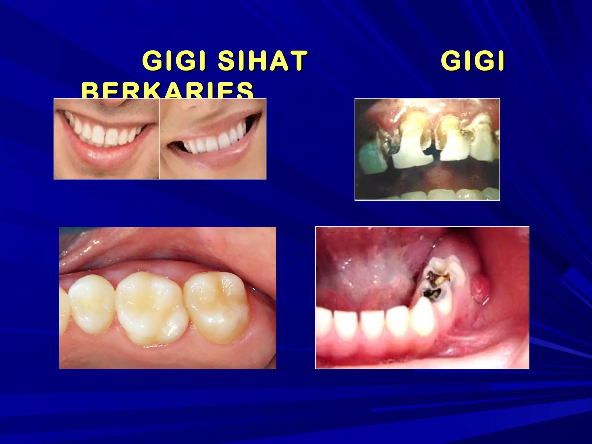 Ceramah pergigian tahap 1 | PPT