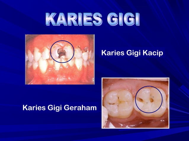 Ceramah pergigian tahap 1 | PPT