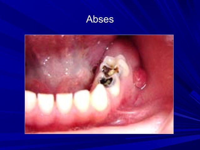 Ceramah pergigian tahap 1 | PPT