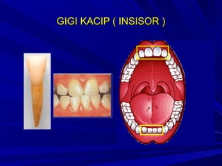 Ceramah pergigian tahap 1 | PPT