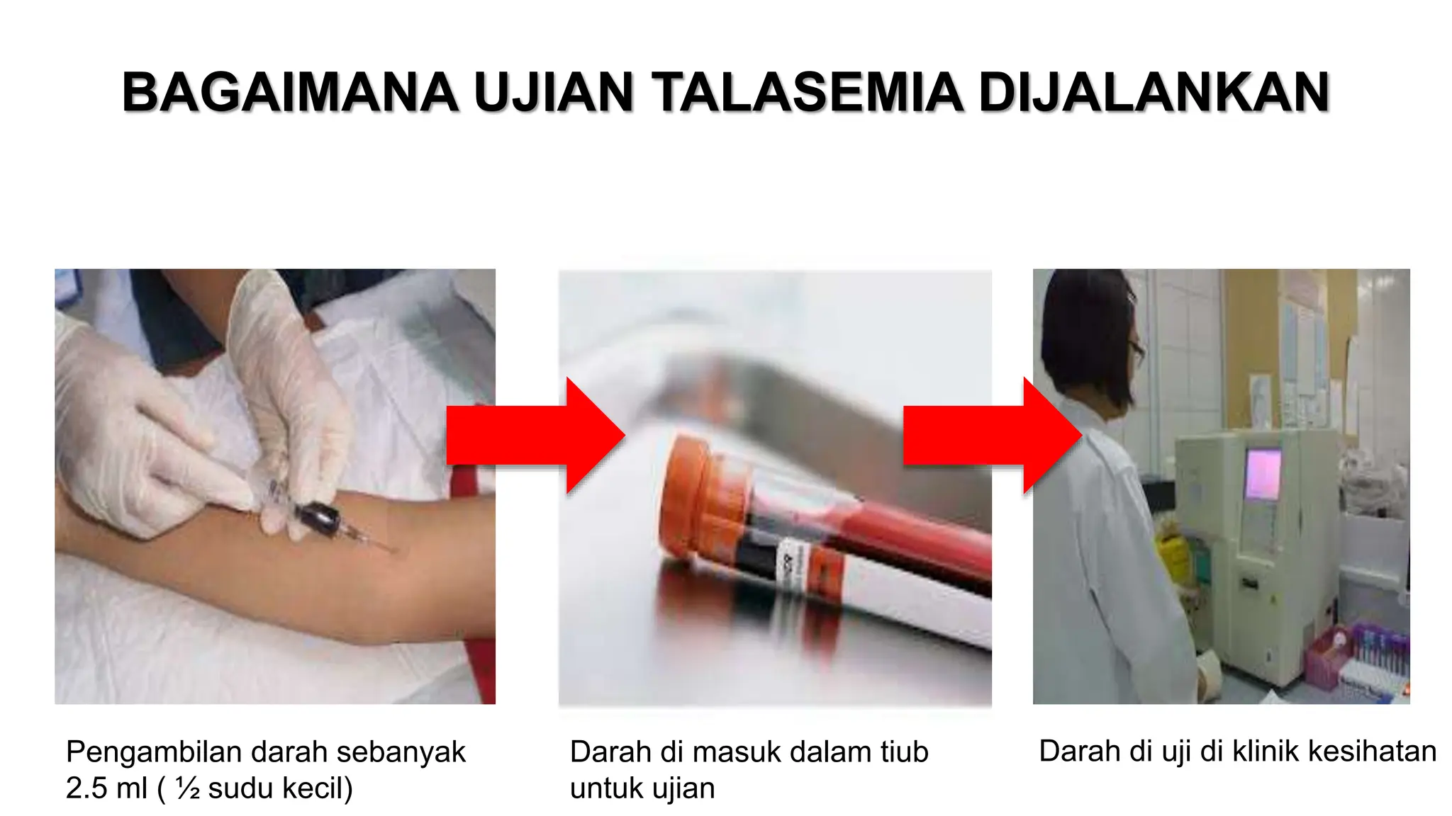 ceramah Thalasemia DR BASIRAH.pptx