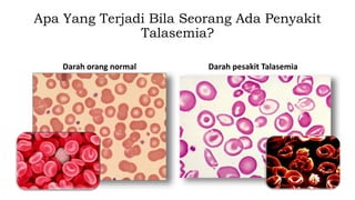 ceramah Thalasemia DR BASIRAH.pptx