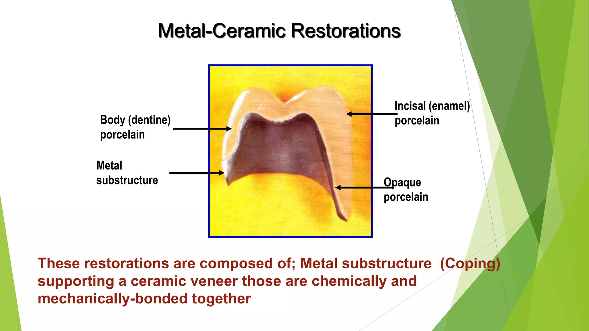 Dental Ceramics and Porcelain fused to metal | PPTX