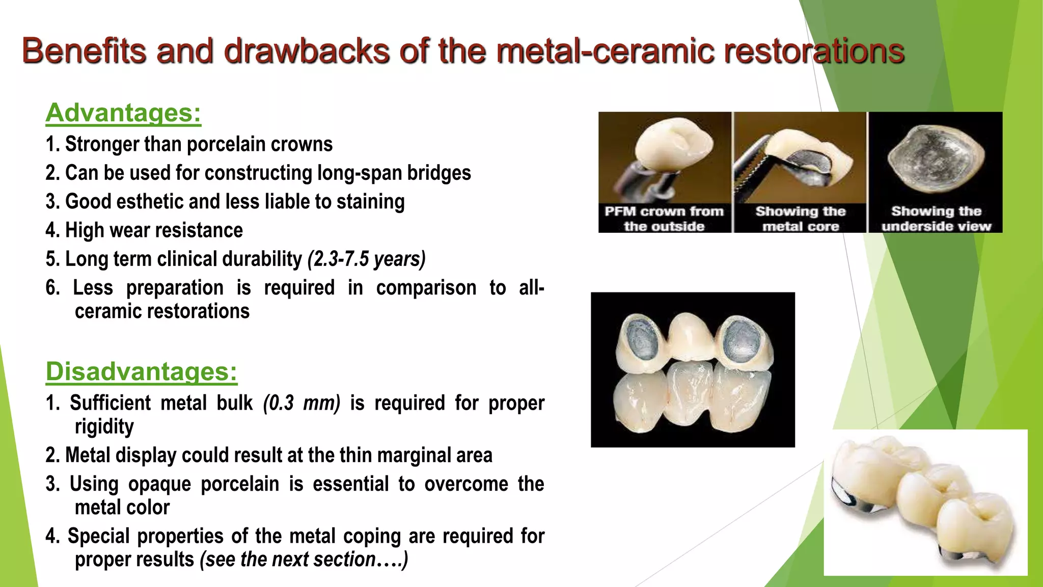 Dental Ceramics and Porcelain fused to metal | PPTX