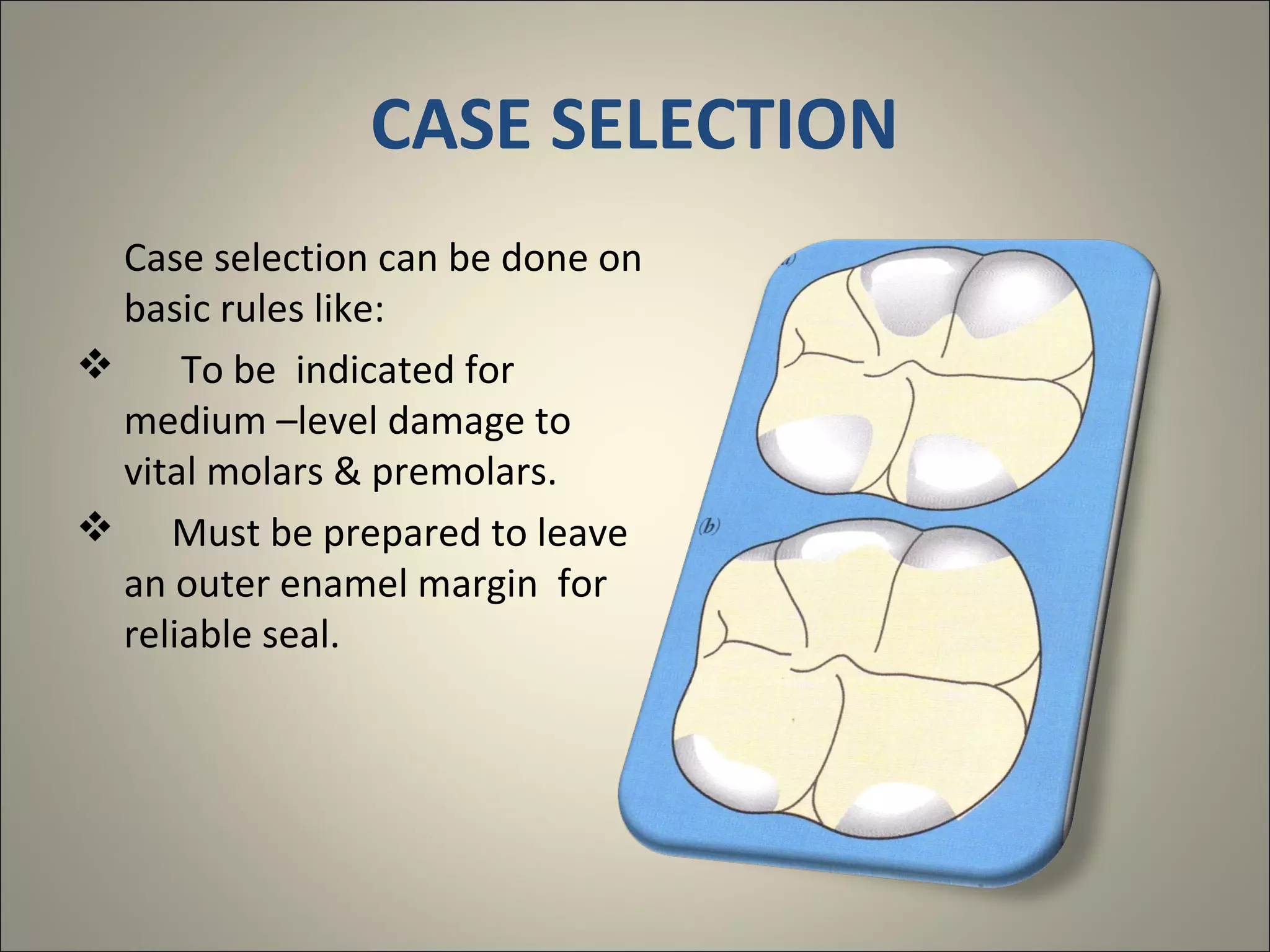 Ceramic inlays and onlays | PPT