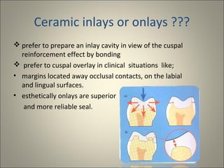 Ceramic inlays and onlays | PPT