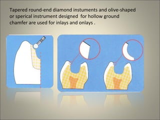 Ceramic inlays and onlays | PPT