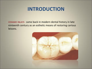 Ceramic inlays and onlays | PPT