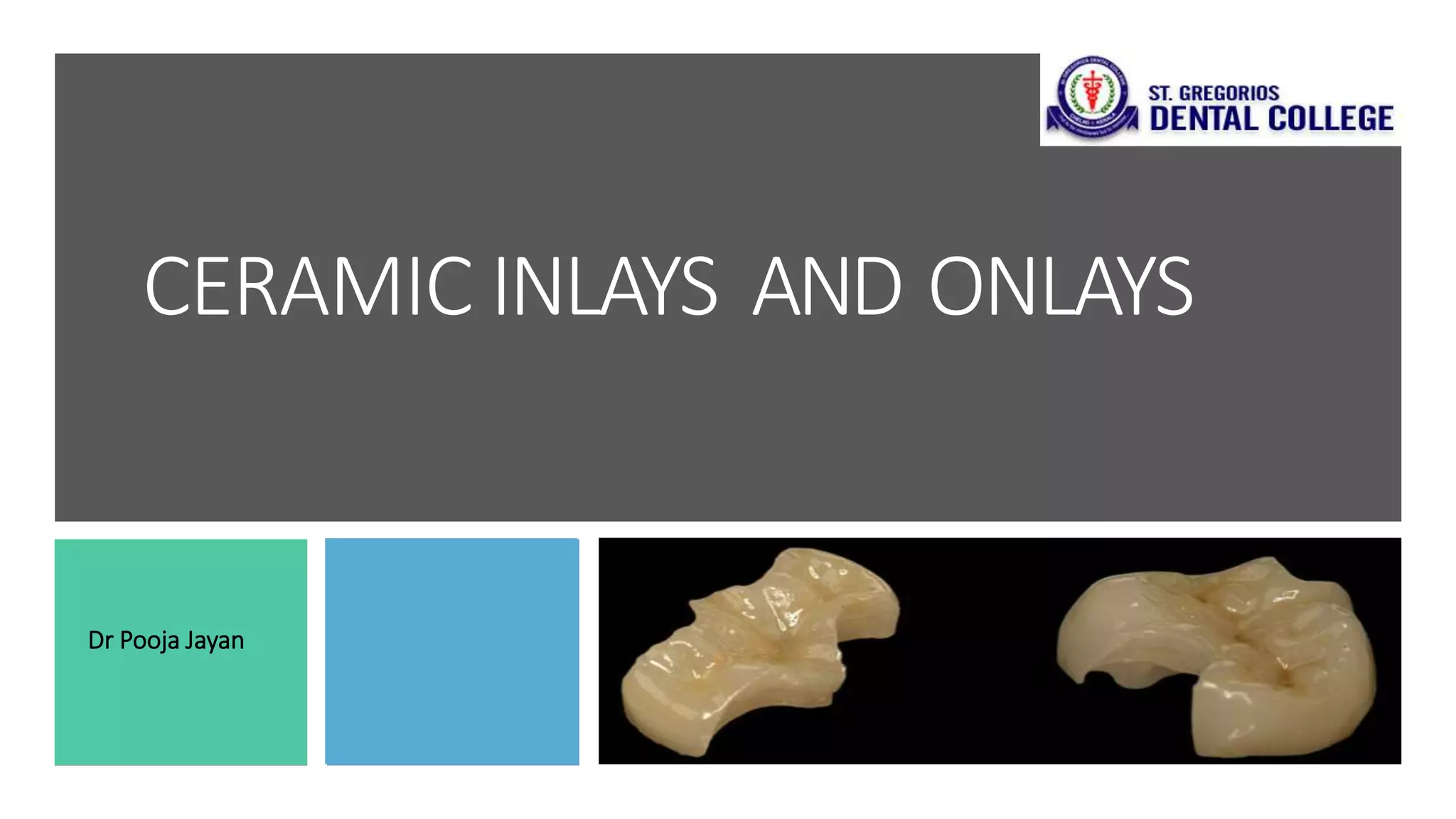 Ceramic inlays and onlays | PPTX