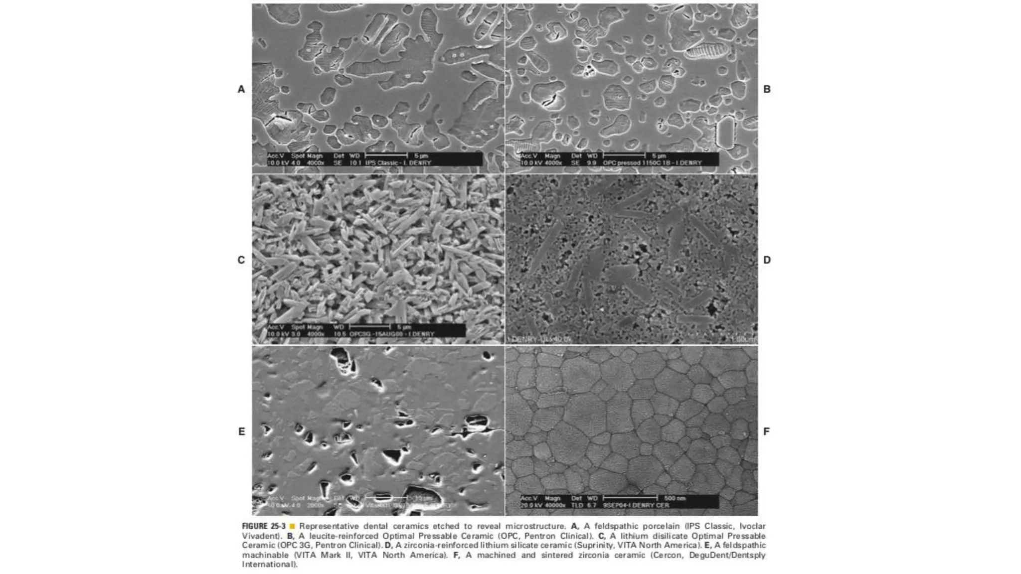all_Ceramic systems | PPTX