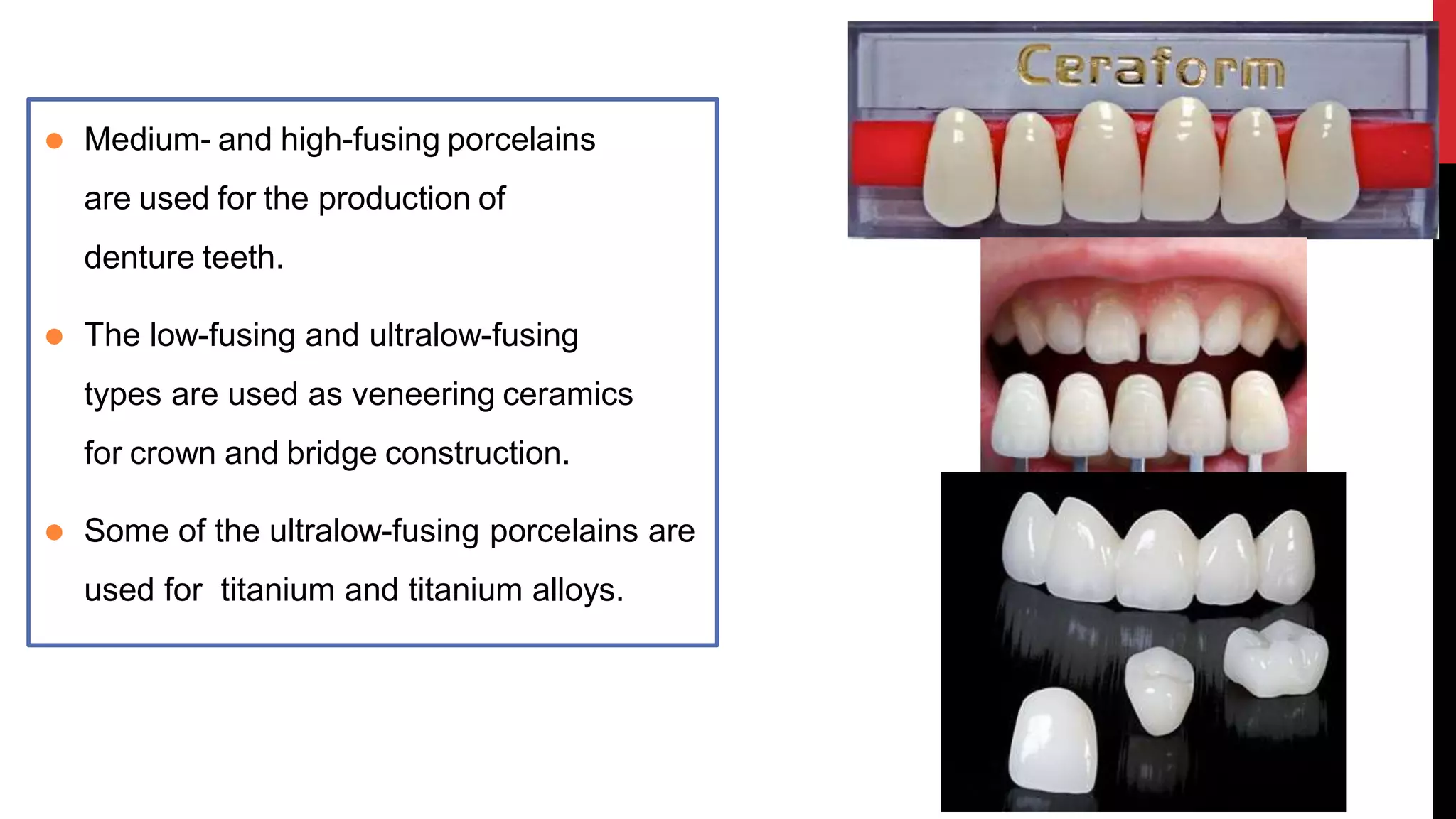 Dental ceramics | PPTX