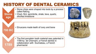 Dental ceramics | PPTX