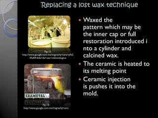 Ceramics for dental use | PPT