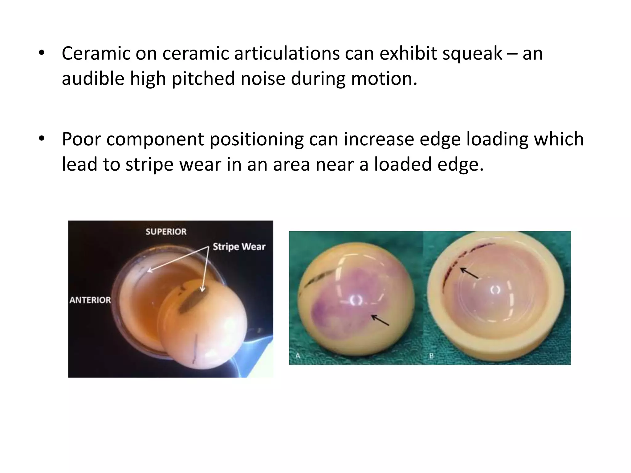 Ceramics in orthopaedics | PPTX