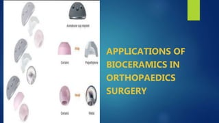 Ceramics in orthopaedics. | PPTX