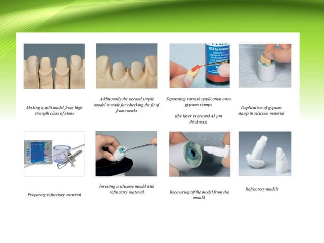 Ceramics ppt.pptx | Dental Health | Diseases and Conditions