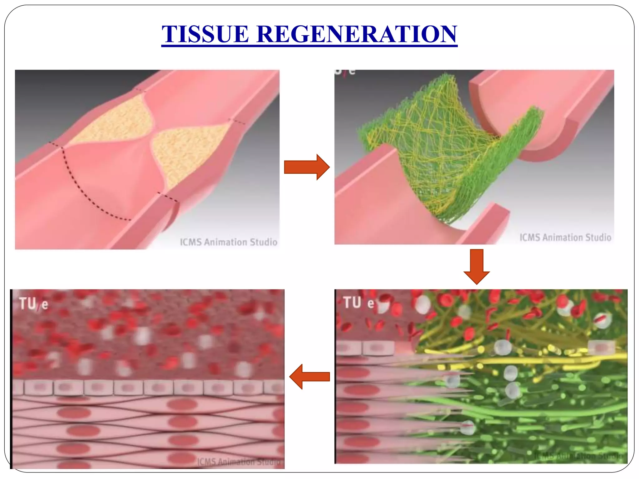 biodegradable ceramics polymer matrix composite for bio medical ...