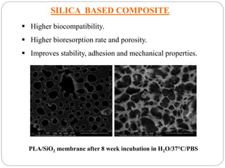 biodegradable ceramics polymer matrix composite for bio medical ...