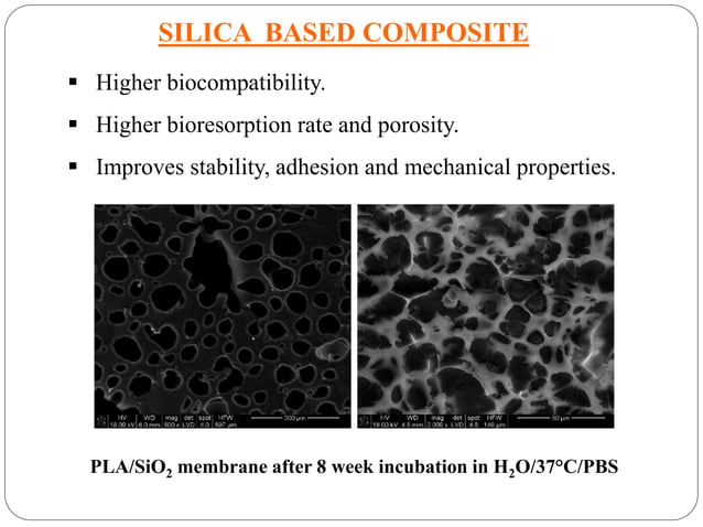 biodegradable ceramics polymer matrix composite for bio medical ...